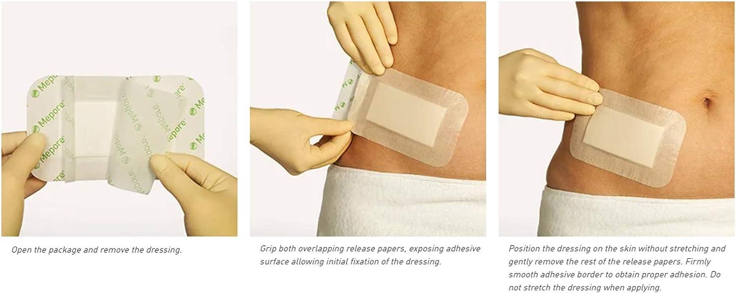 Mepore Pro 2.4 x 3 (6 x 7 cm) | High-Quality Adhesive Dressing for ...