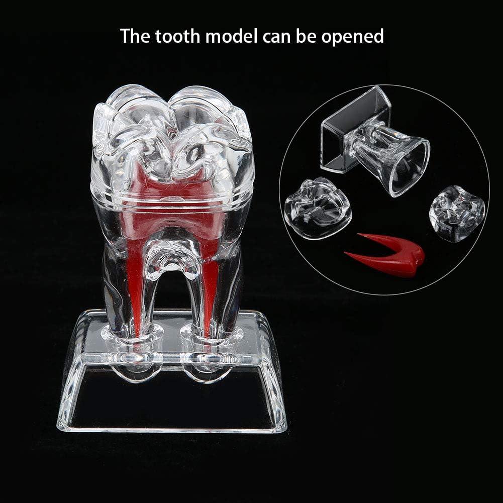 Discriminable Toothed Tooth Model for Endodontics | Plastic Teeth ...
