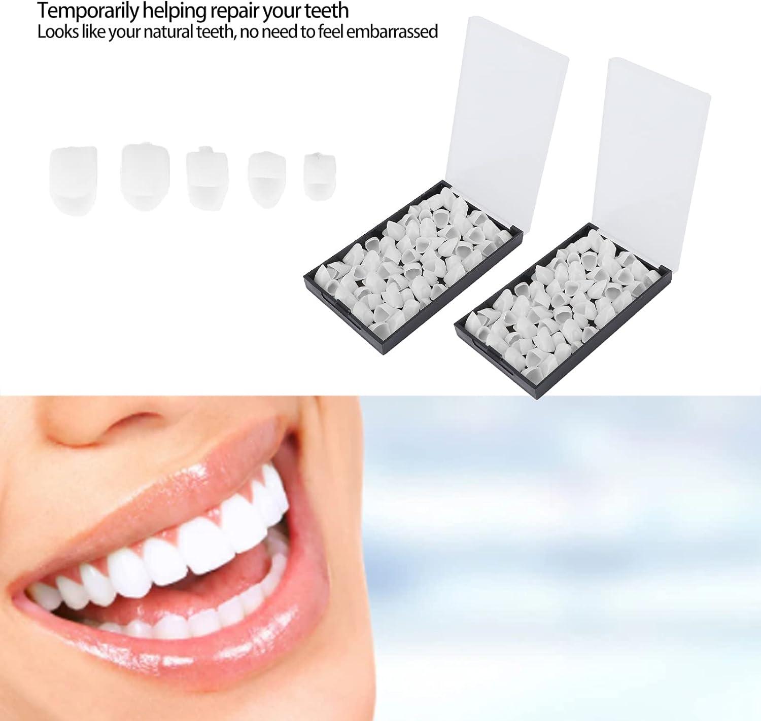 Dental Crowns Kit - 120pcs Safe Temporary Front Teeth Veneers ...