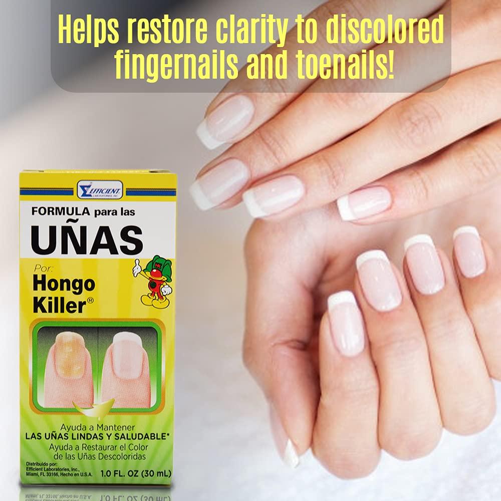 Hongo Killer Nail Formula 1 oz - Pack of 12 | Fast & Effective Nail ...
