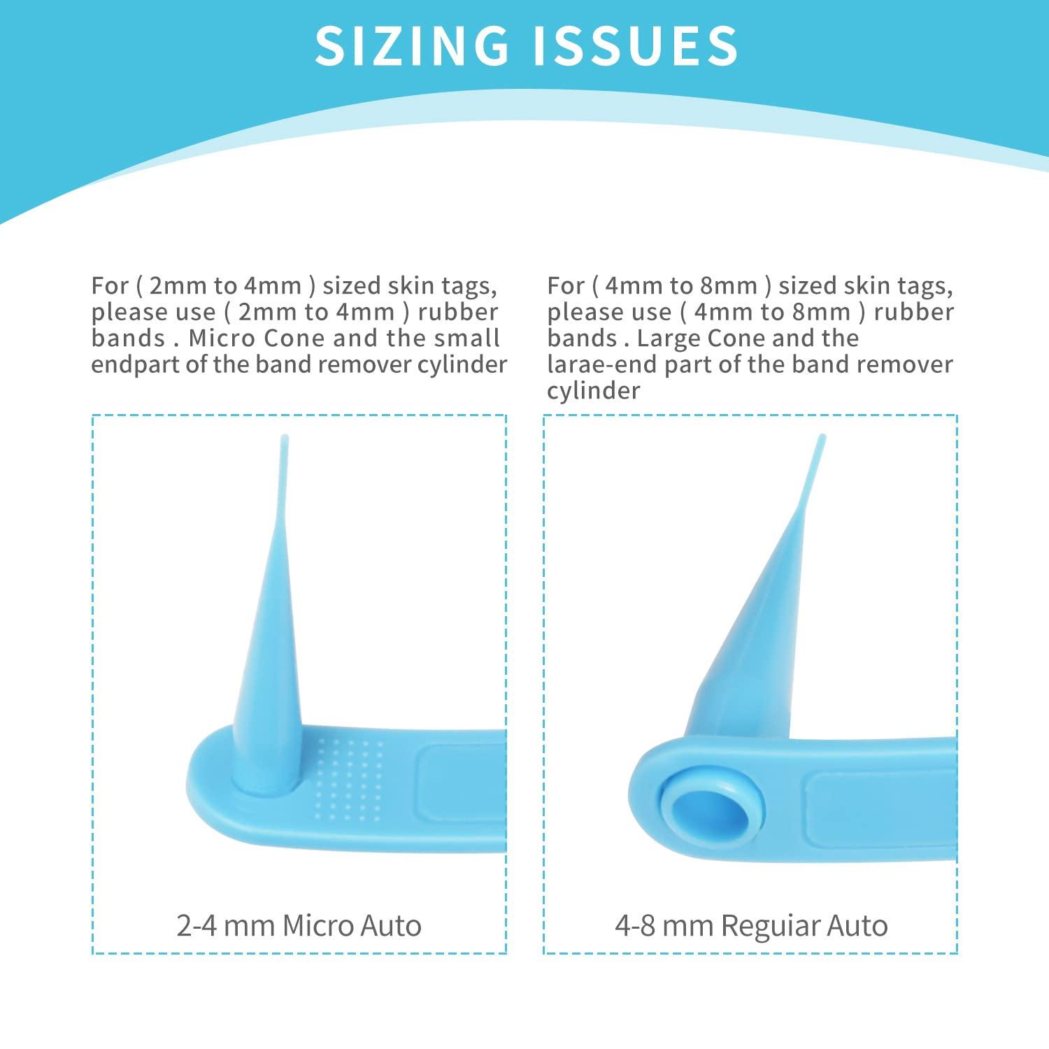 skin tag remove with thread