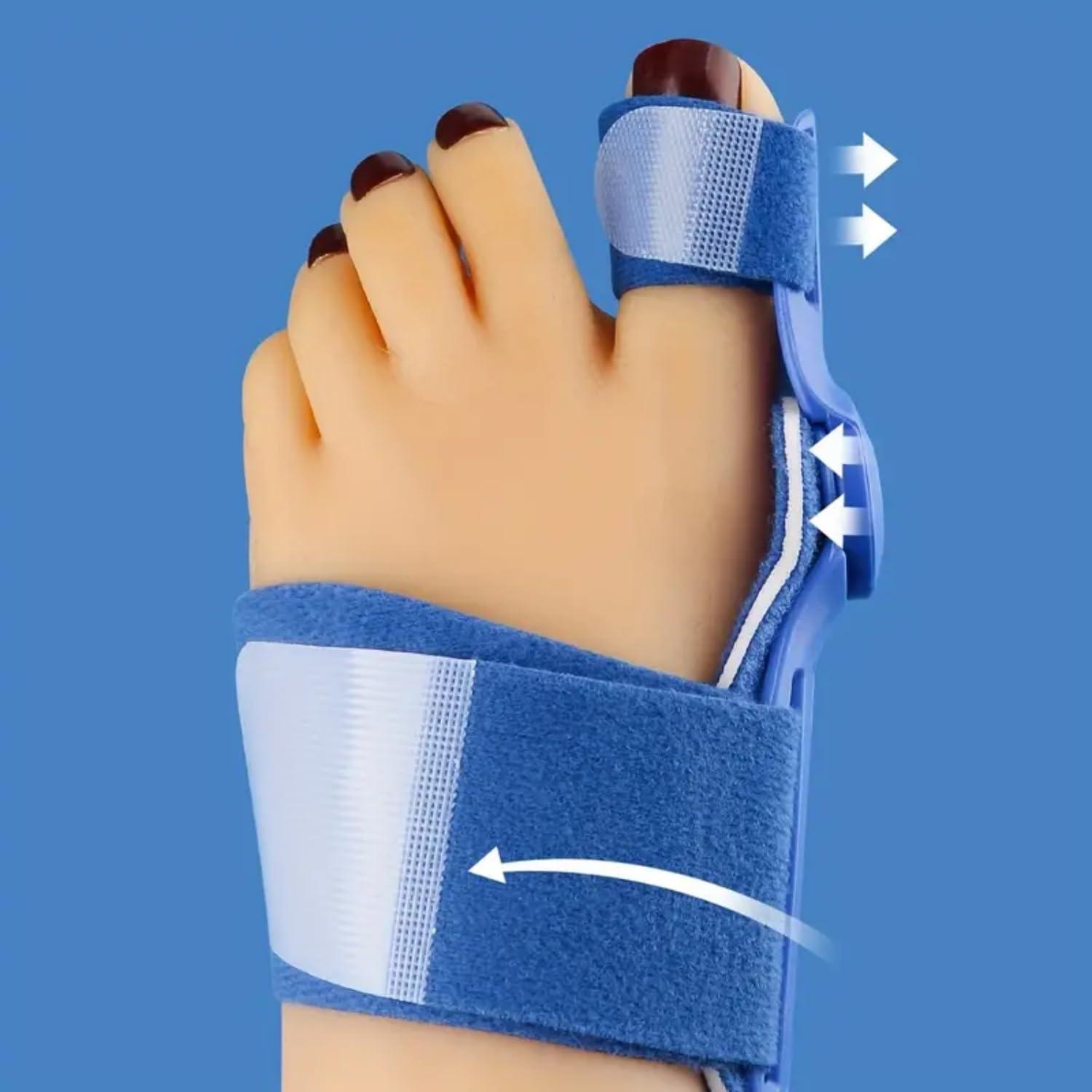 Hiseeyo Upgraded Bunion Corrector for Women - Big Toe Hallux Valgus ...