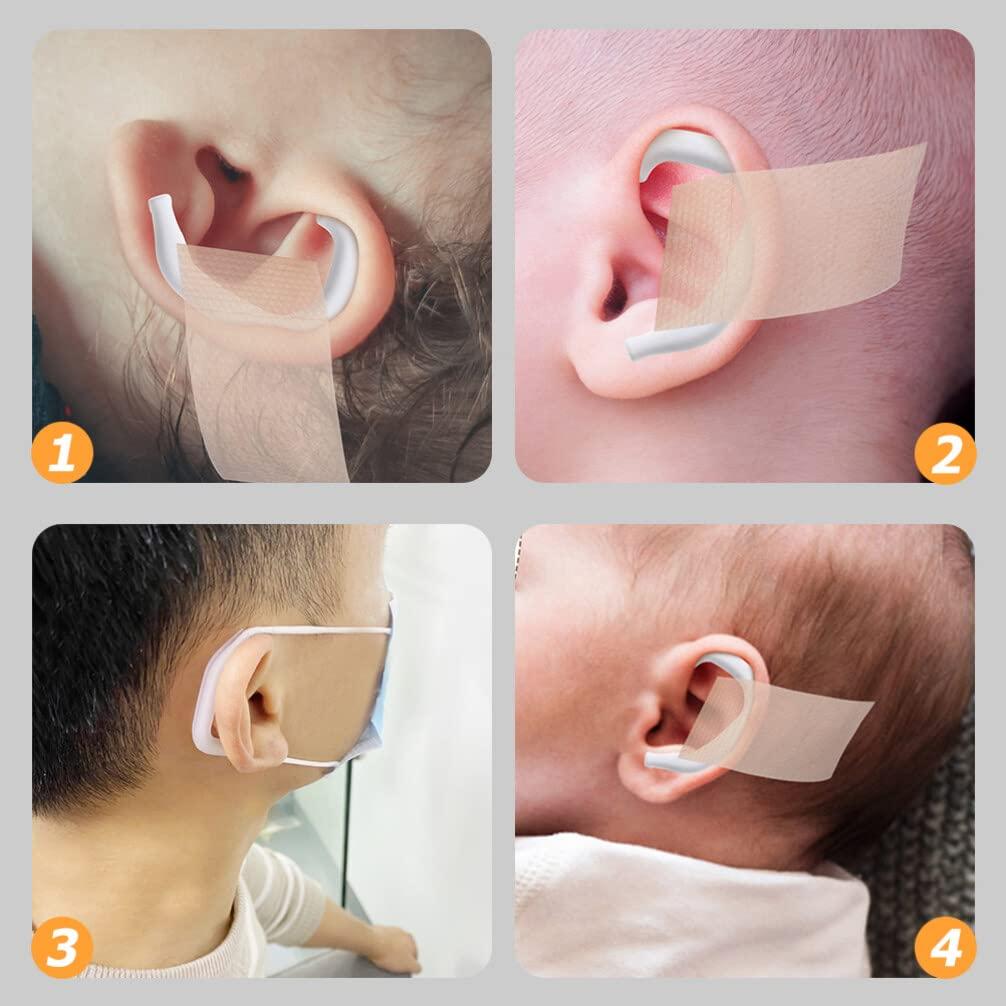 Protruding Ear Support - 5 Pairs Silicone Aesthetic Corrector for ...