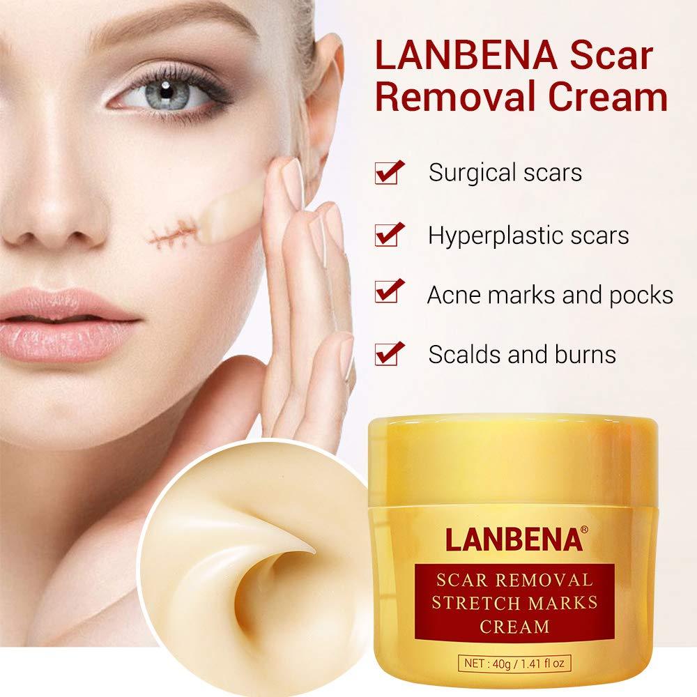 LANBENA Acne Scar Removal Cream - Herbal Gel for Surgical Scars, Burns, Stretch Marks, Acne ...
