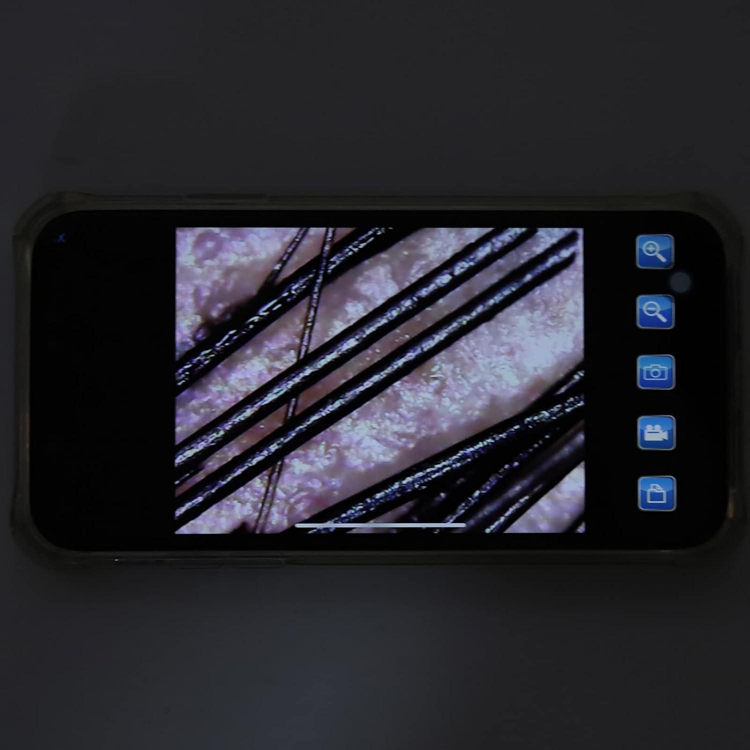 100X Magnification Skin Hair Scalp Detector | 2MP Camera Skin Health ...