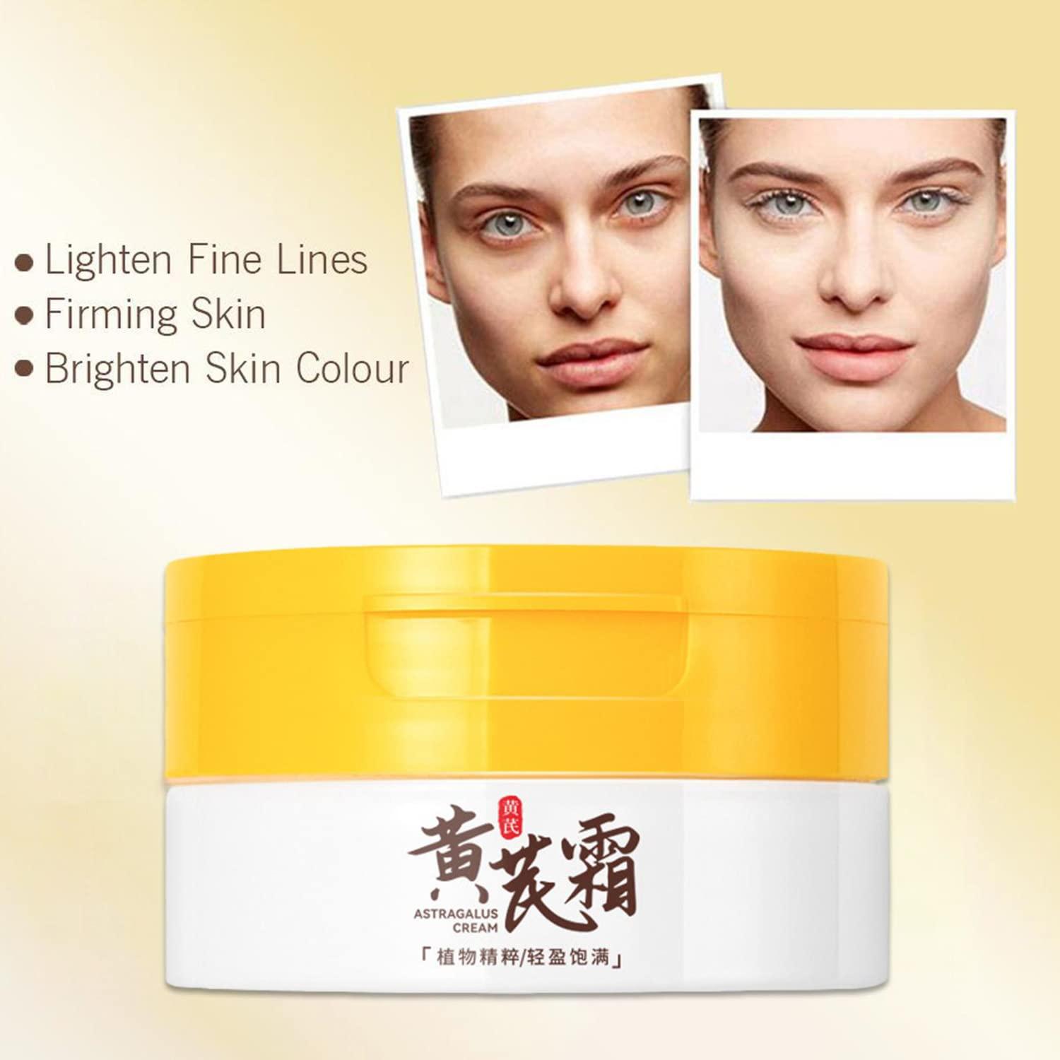 70G Chinese Astragalus Whitening Cream - Remove Freckles Melasma & Dark ...