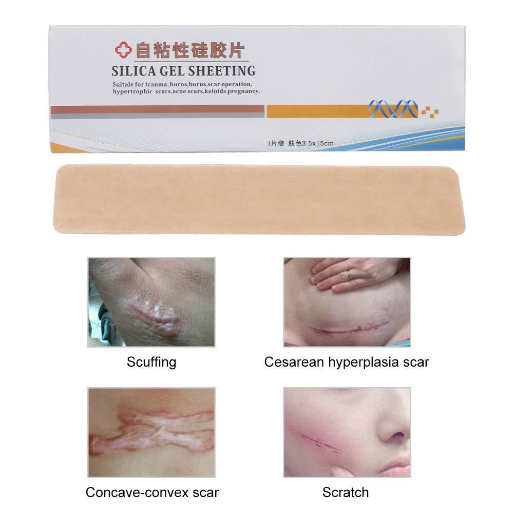 Silicone Scar Sheet for Professional Scar Removal - Wound Marks and ...