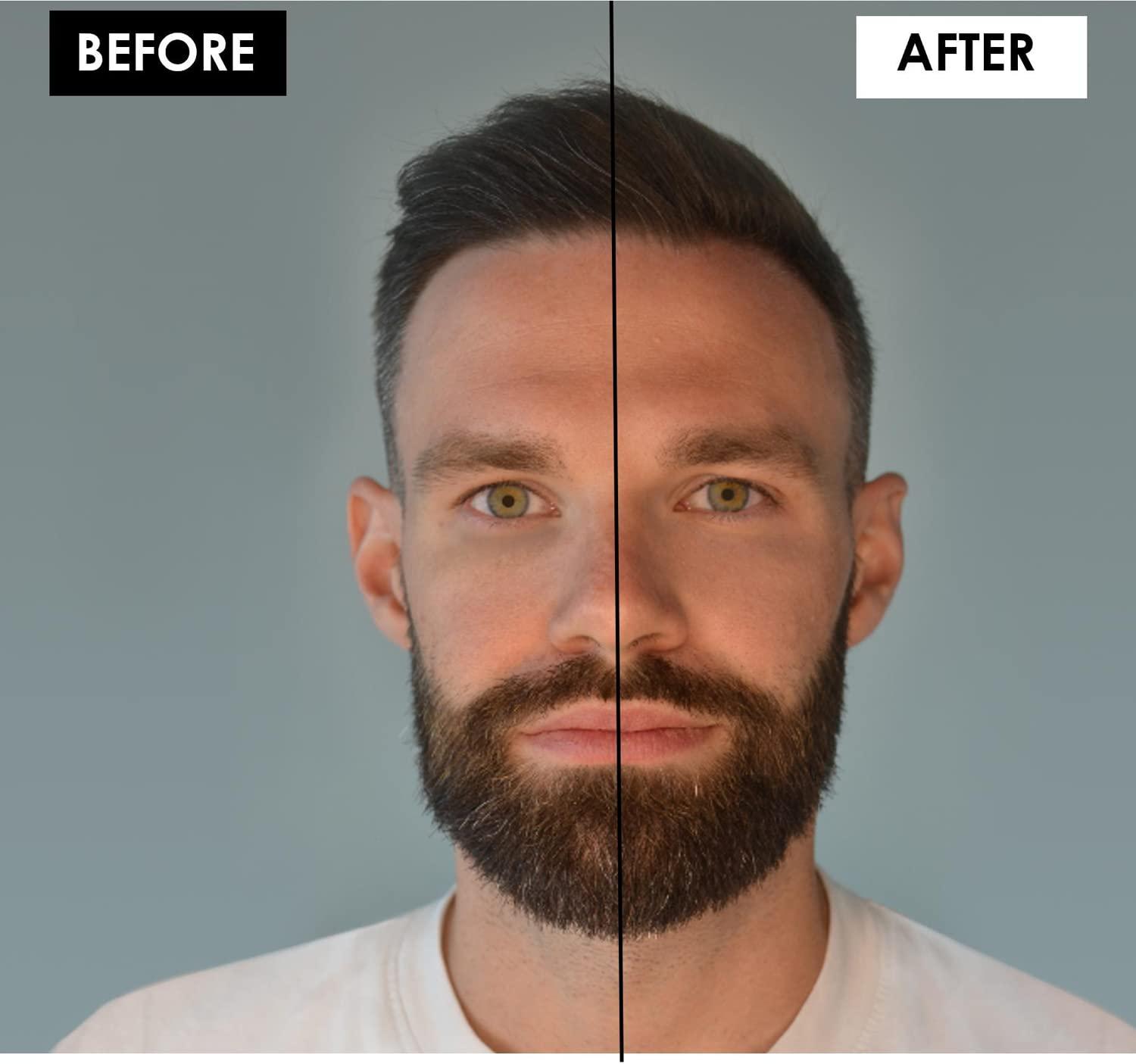 concealer before after men