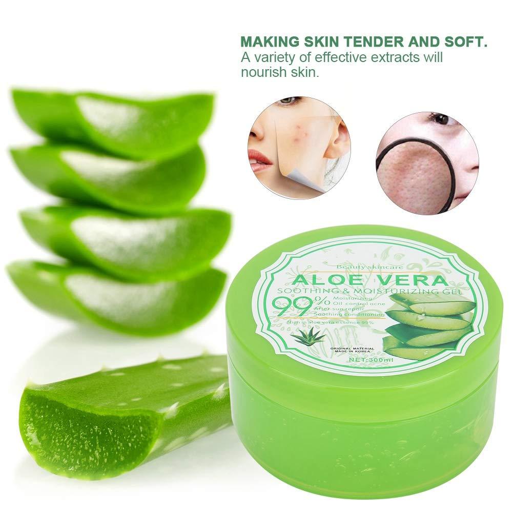 Organic Aloe Vera Gel 300g | Moisturizing for Damaged Skin Acne Scars ...