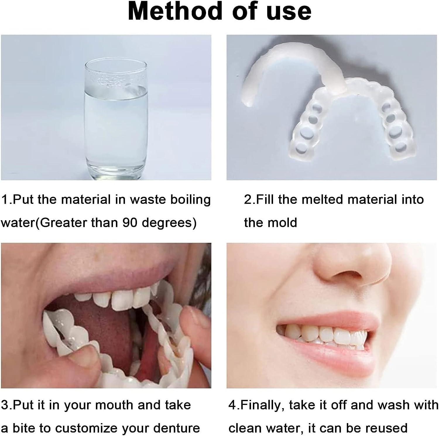OTCPP 2 Pairs Temporary Teeth Kit Decor Dental Veneers for Temporary ...
