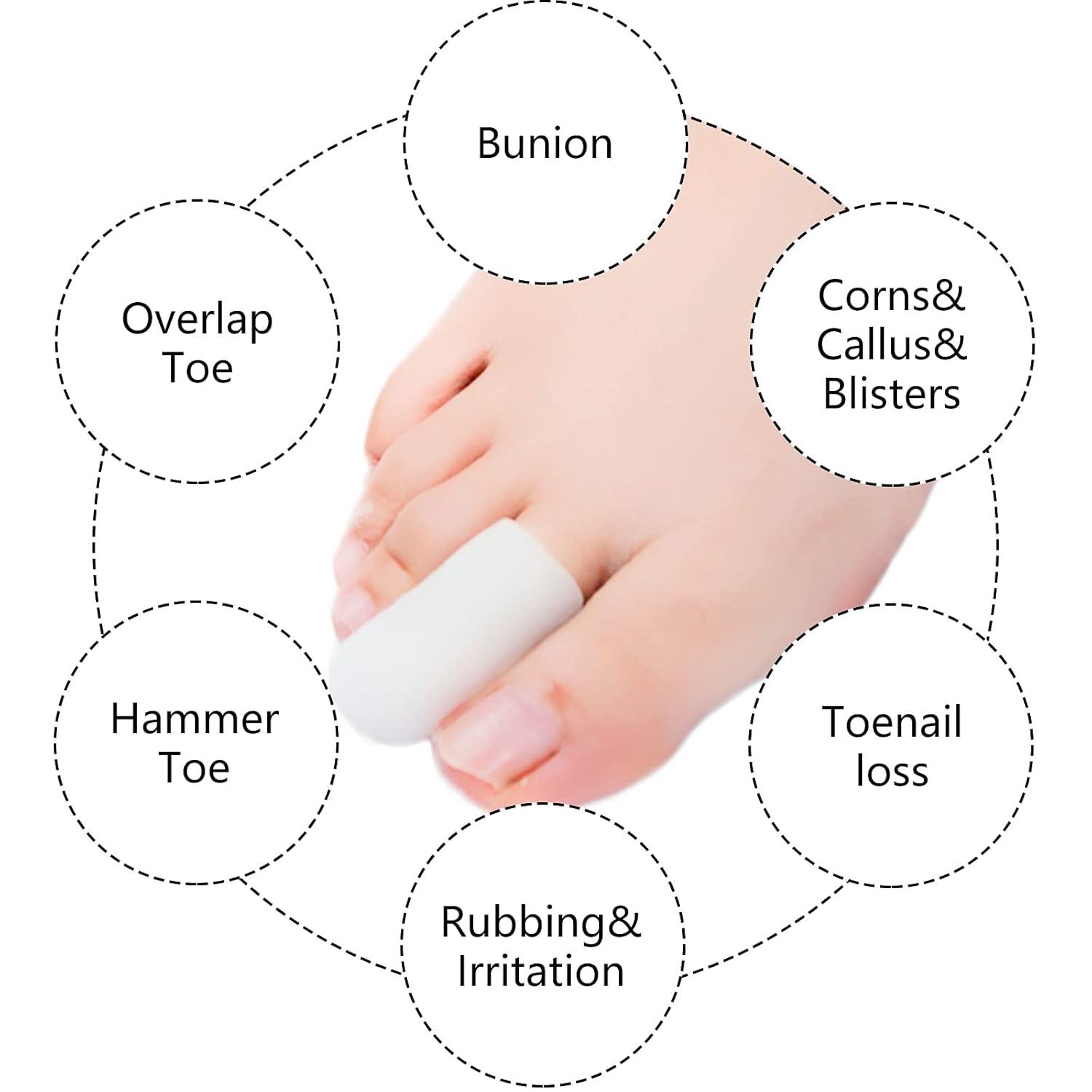 Gel Toe Caps & Protectors - 10 Pack for Pain Relief Corns & Calluses ...