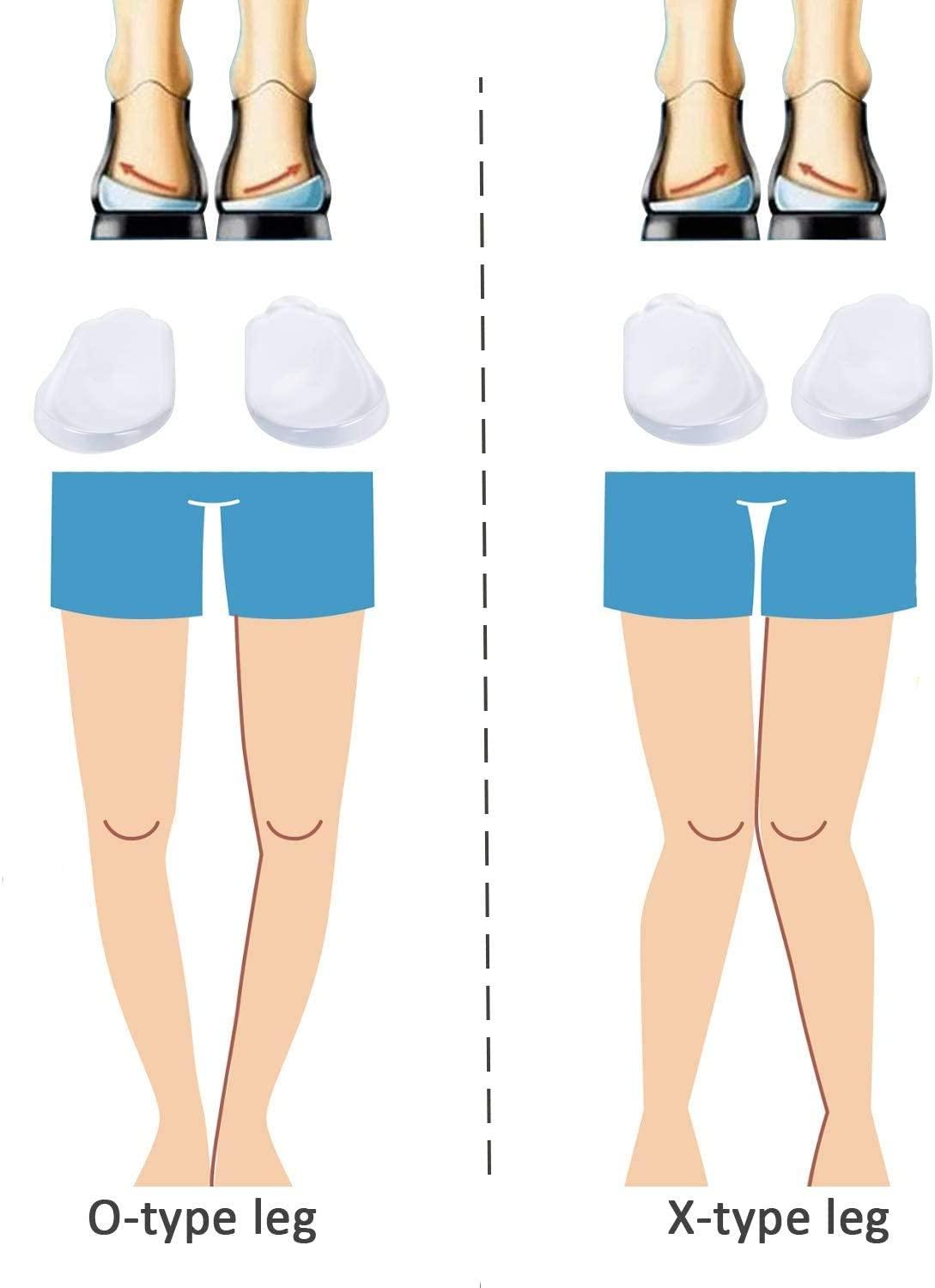 Orthopedic Insoles for Corrective Pronation & Supination - 4 Pairs ...