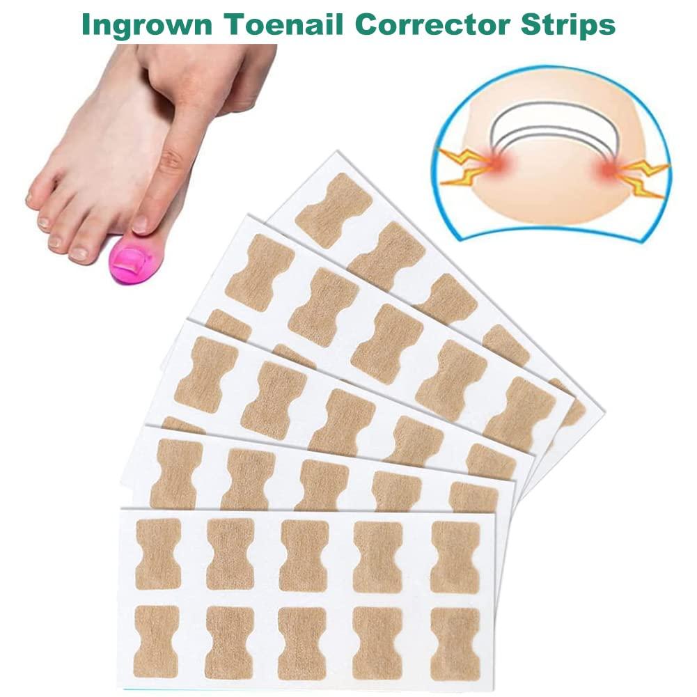 Ingrown Toenail Corrector Patch - 50PCS Natural Strips for Painless ...