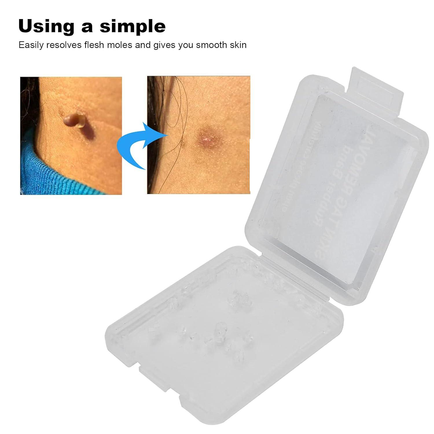 30 Pcs Skin Tag Removal Rubber Bands Natural Facial Care Micro Band for ...