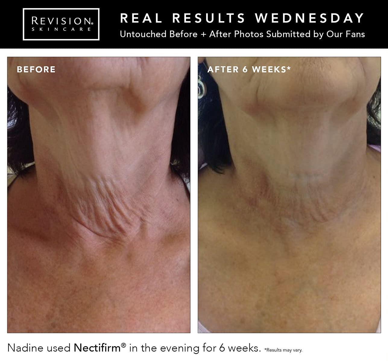 Revision Skincare Nectifirm Tube 8 oz - Advanced Neck Firming Cream ...