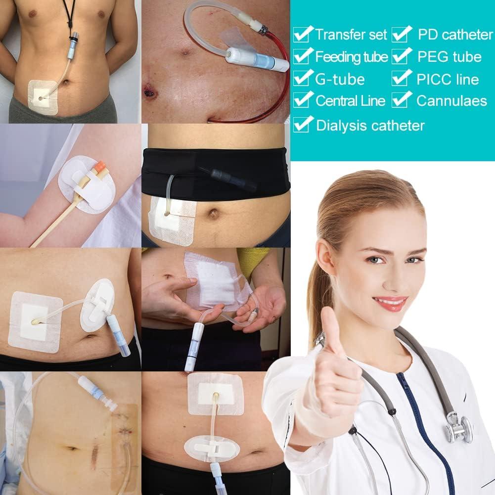 Feeding Tube Adhesive Wound Dressing - 4"x4" Bandage for PEG GJ & Supra ...