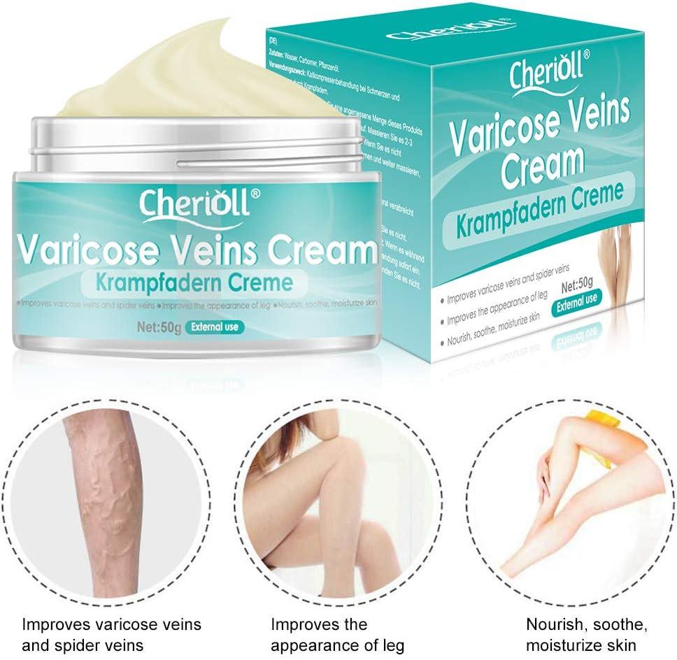 Varicose Veins Cream | Best Treatment for Spider Veins & Inflammation ...
