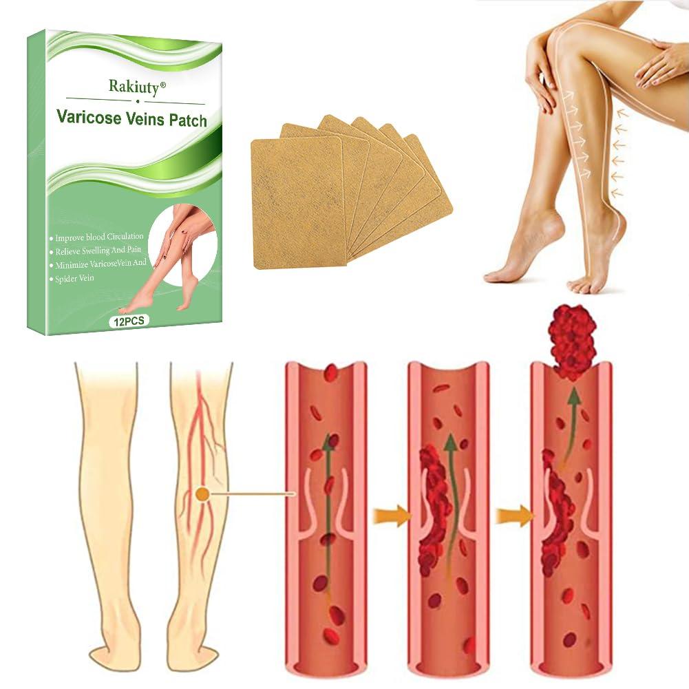 Varicose Veins Patch - Effective Treatment for Spider Veins | 12 Pcs ...