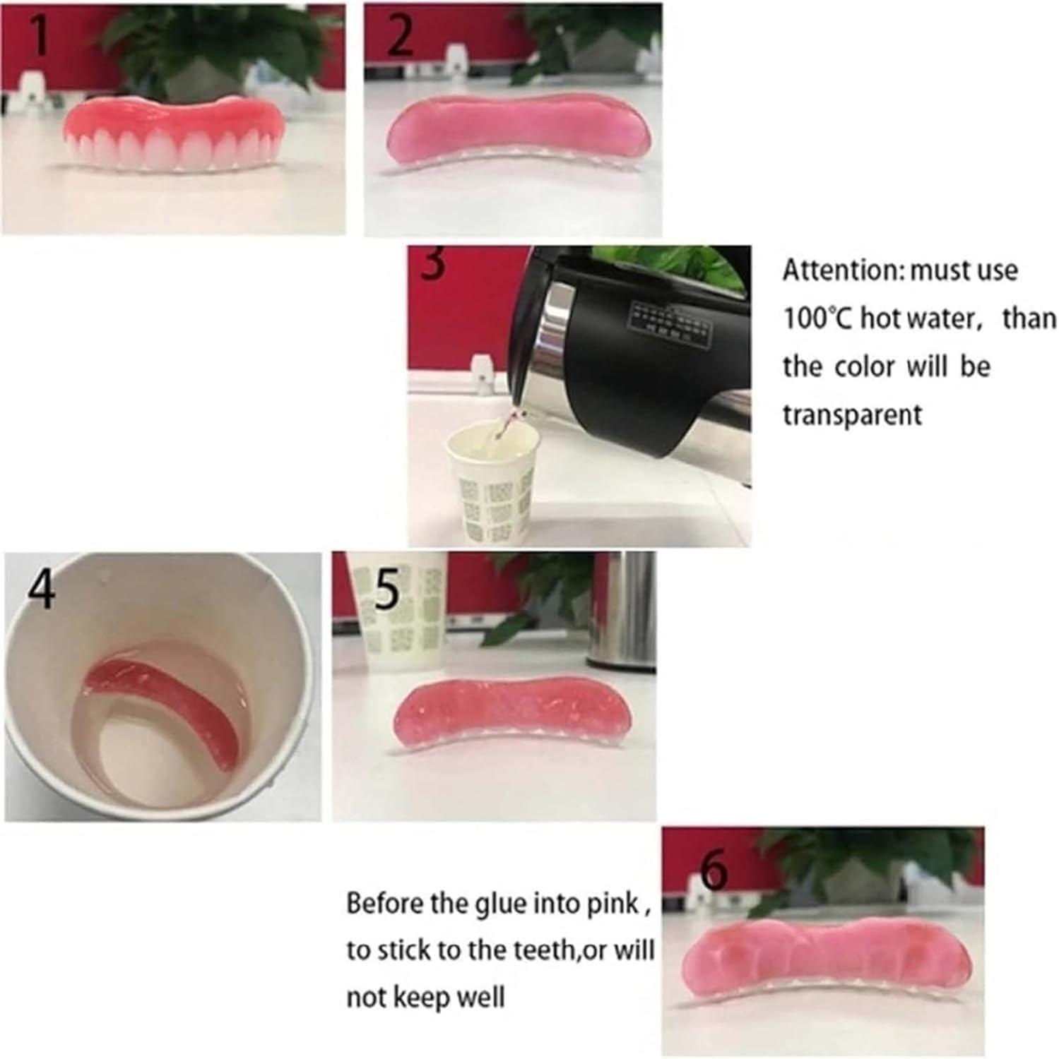 Frenzify Immediate Cosmetic Teeth Veneers - 2 Pairs of Lightening ...