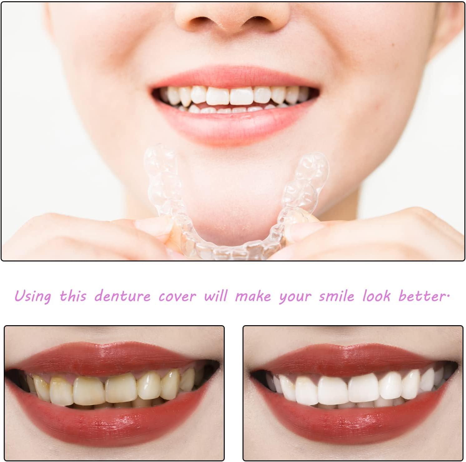 Buy 2 Pairs of Plug-in Teeth | Immediate Cosmetic Veneers & Dental ...