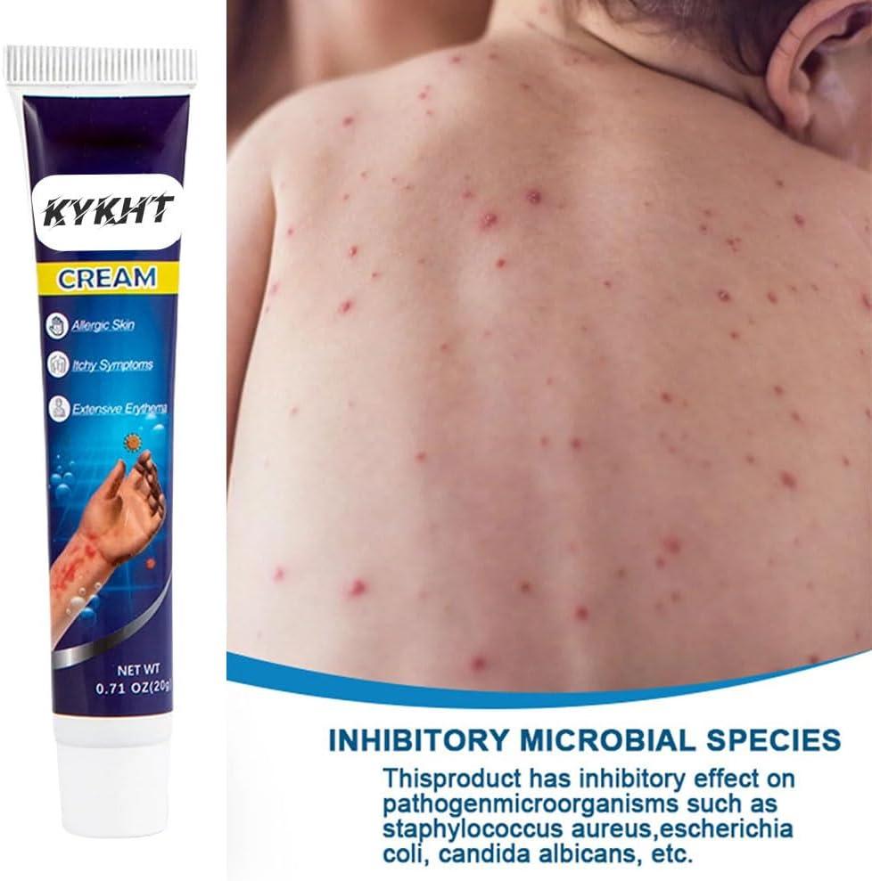 KYKHT Urticaria Antipruritic Ointment Urticaria Curing Plaster Ointment ...