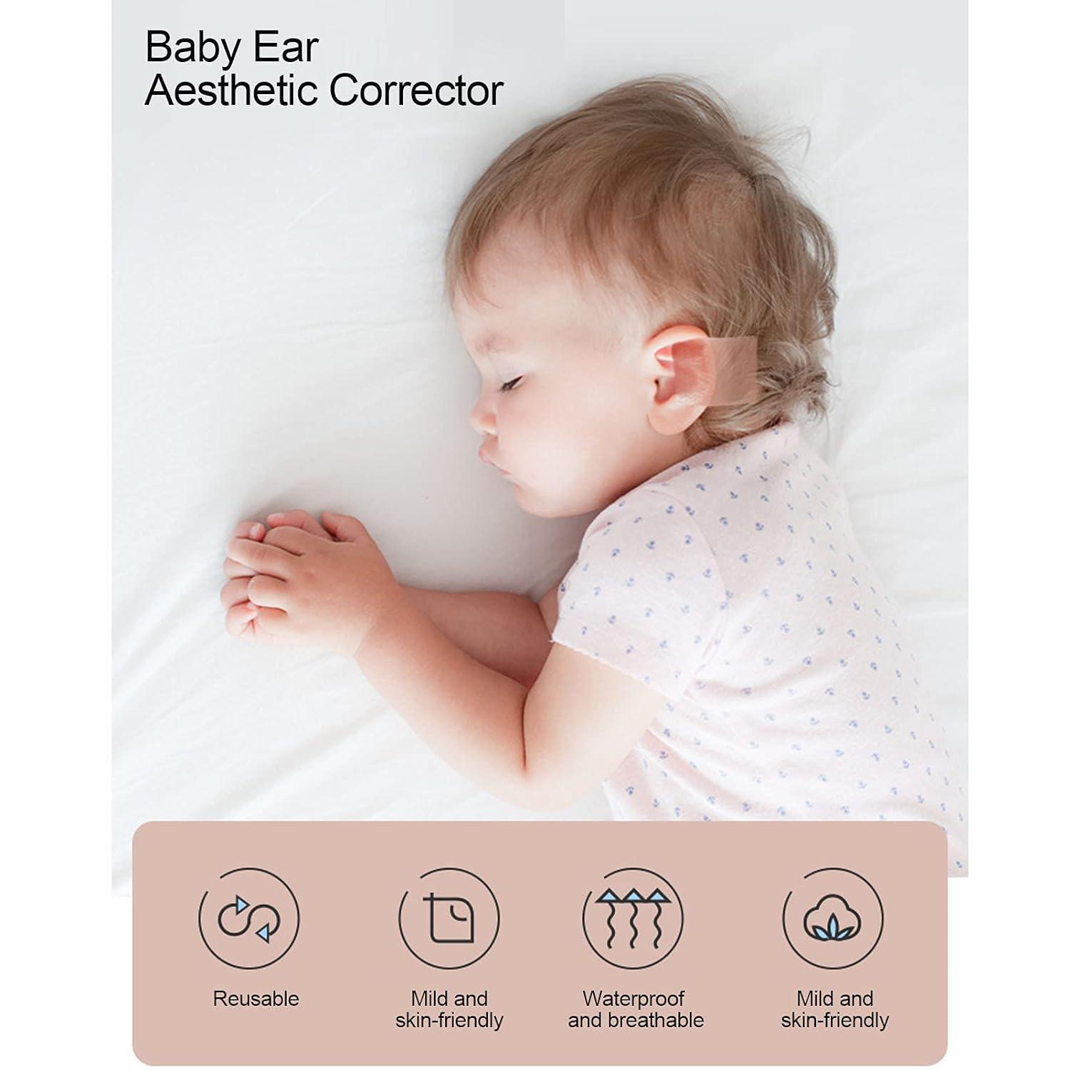 Baby Ear Correction Patch | Protruding Ear Aesthetic Corrector Gel Tape ...