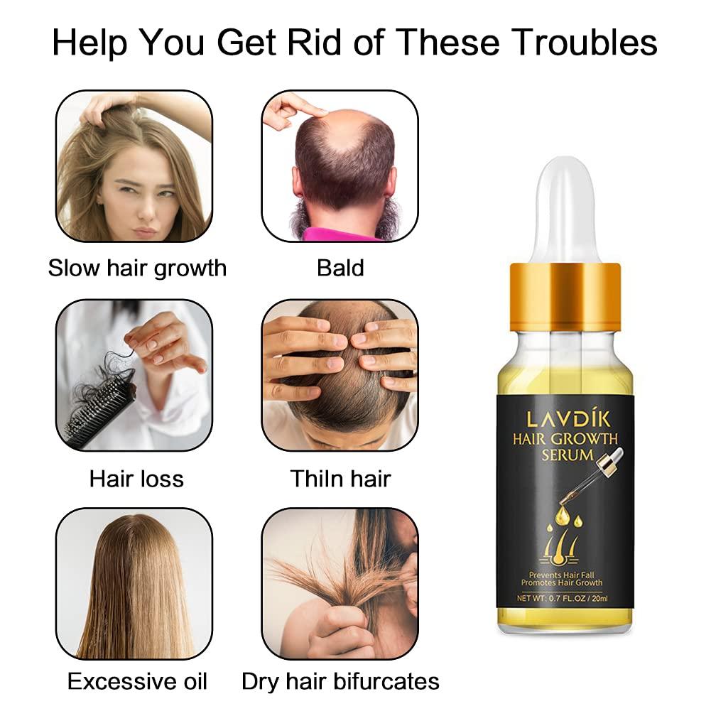 Ysimee Hair Growth Serum 20ml | Biotin & Herbal Anti-Hair Loss Formula ...