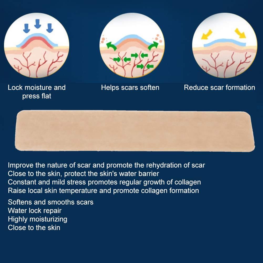 Silicone Scar Sheet - Self Adhesive, Portable & Durable for Wound Marks ...
