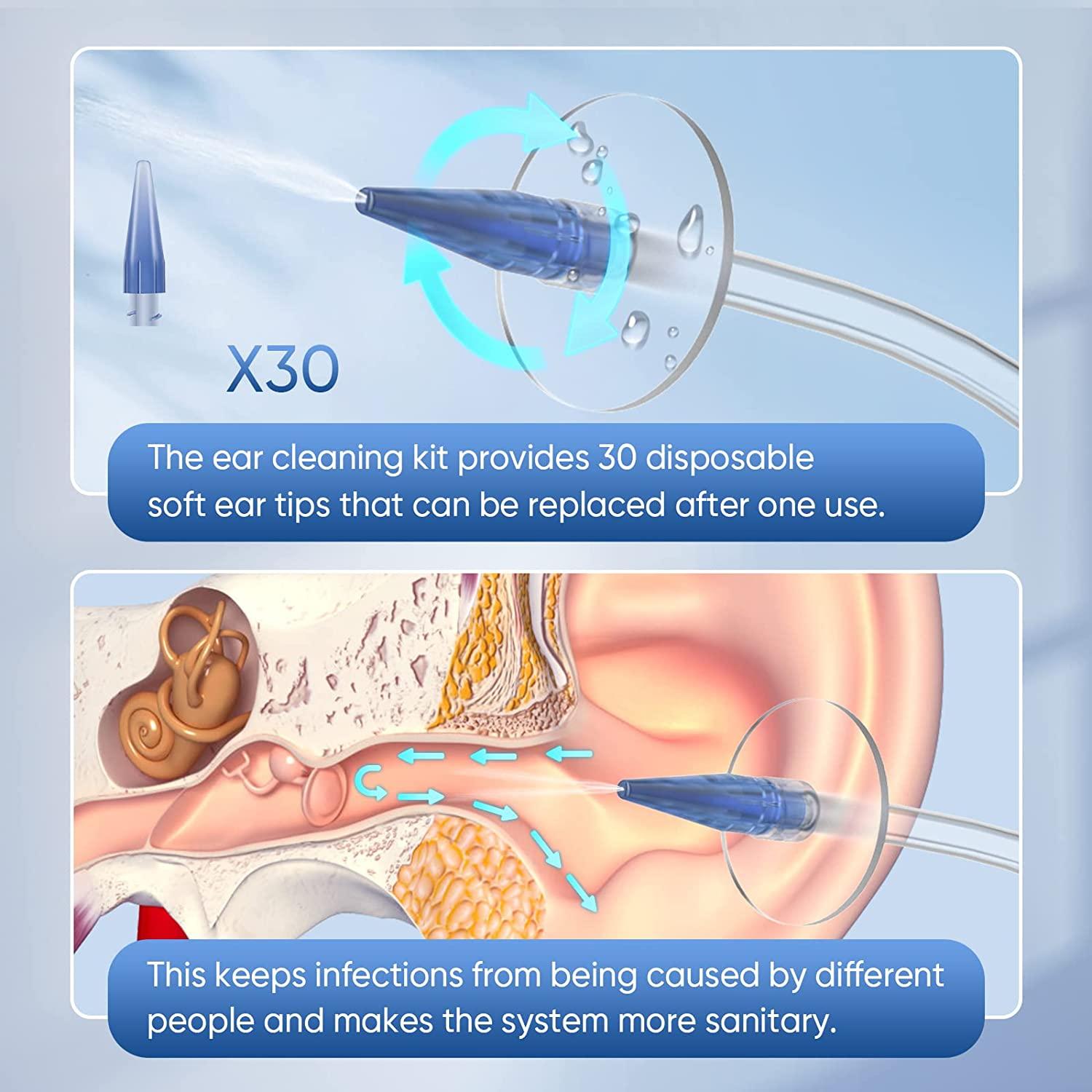 WEUANY Ear Wax Removal Kit - Safe & Effective Manual Ear Irrigation ...