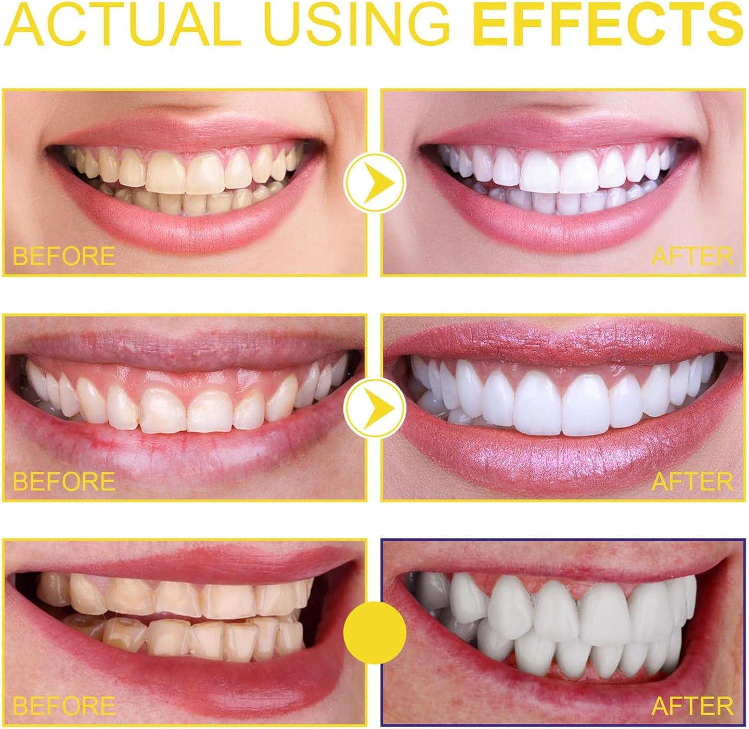 Propolis Smile Mouthwash - Total Care for Teeth & Gum Health ...