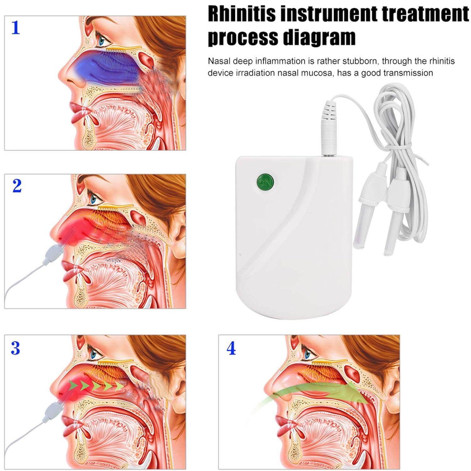 Effective Nose Rhinitis Treatment Device - Relieve Stuffy Nose Sneezing ...