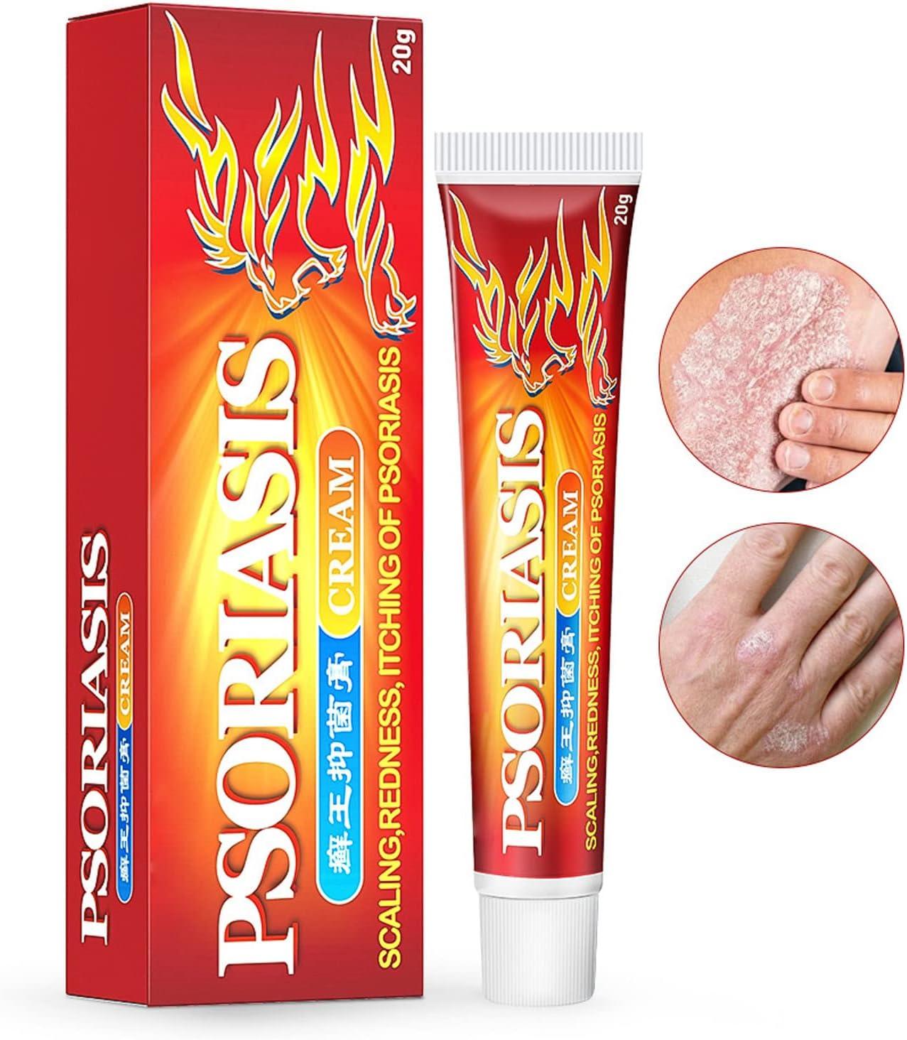 Skin Soothing Cream for Dry, Itchy & Irritated Skin - 20g | Buy Now ...