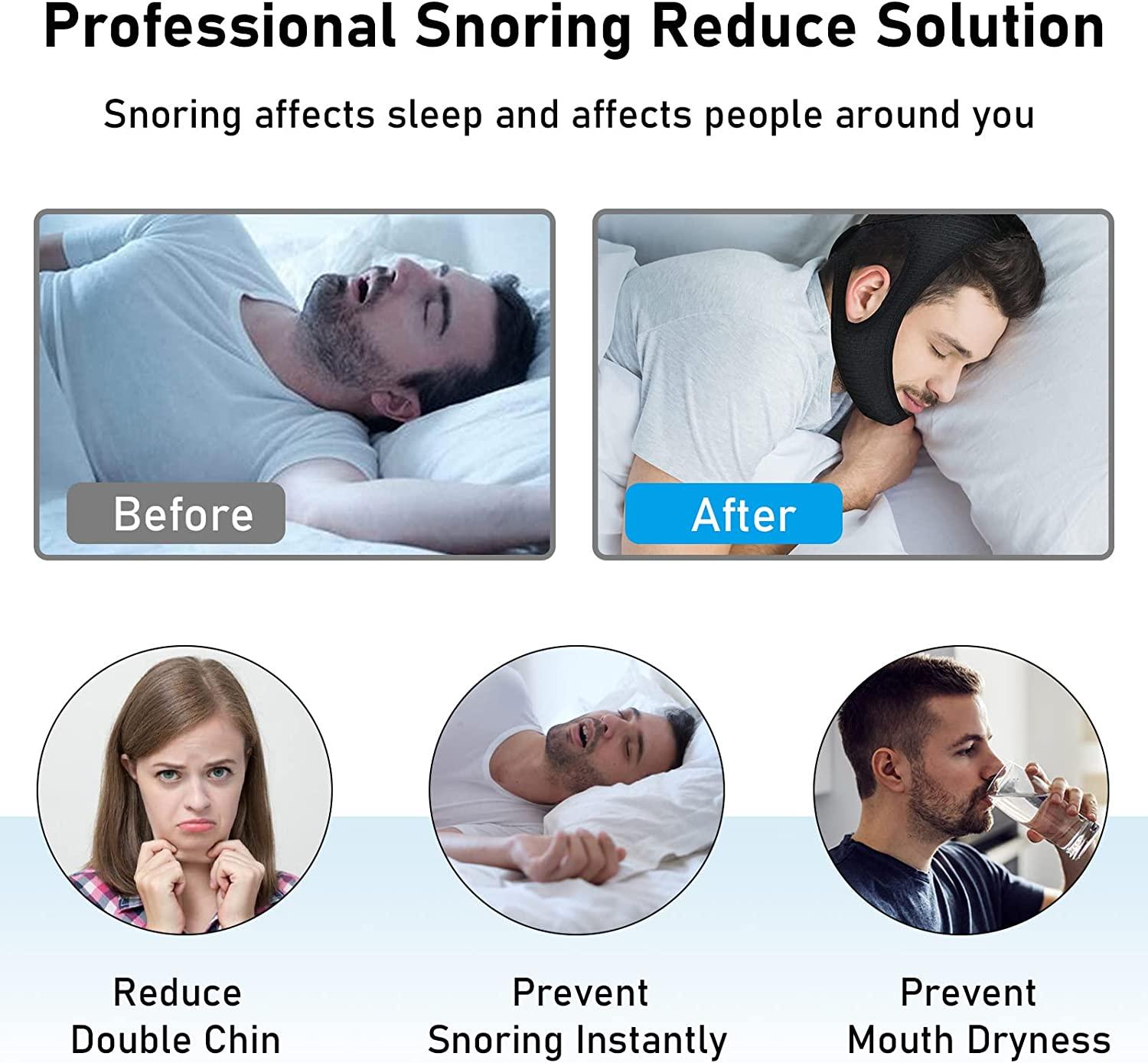 Forzacx Breathable CPAP Chin Strap - Anti-Snoring Solution for CPAP ...