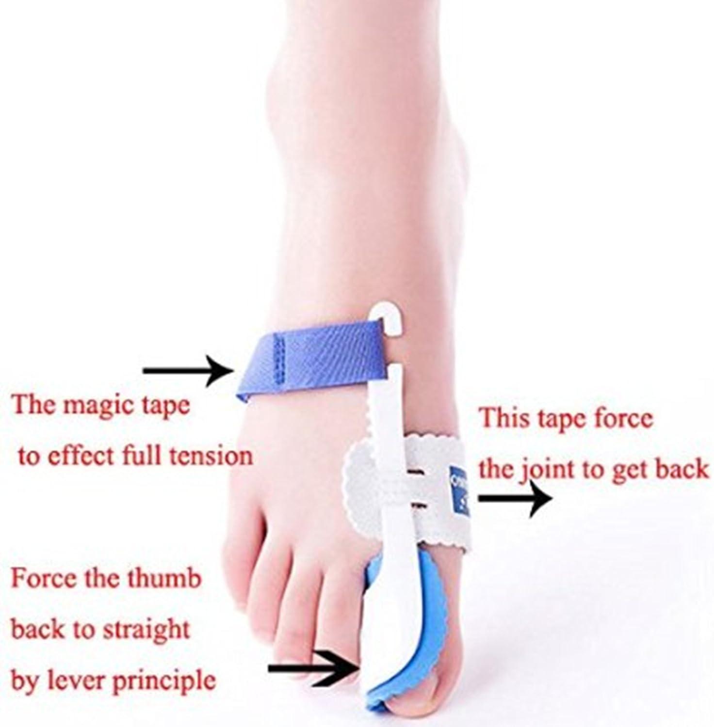 HiiBaby Night Time Splint Big Toe Straightener Bunion Hallux Valgus ...