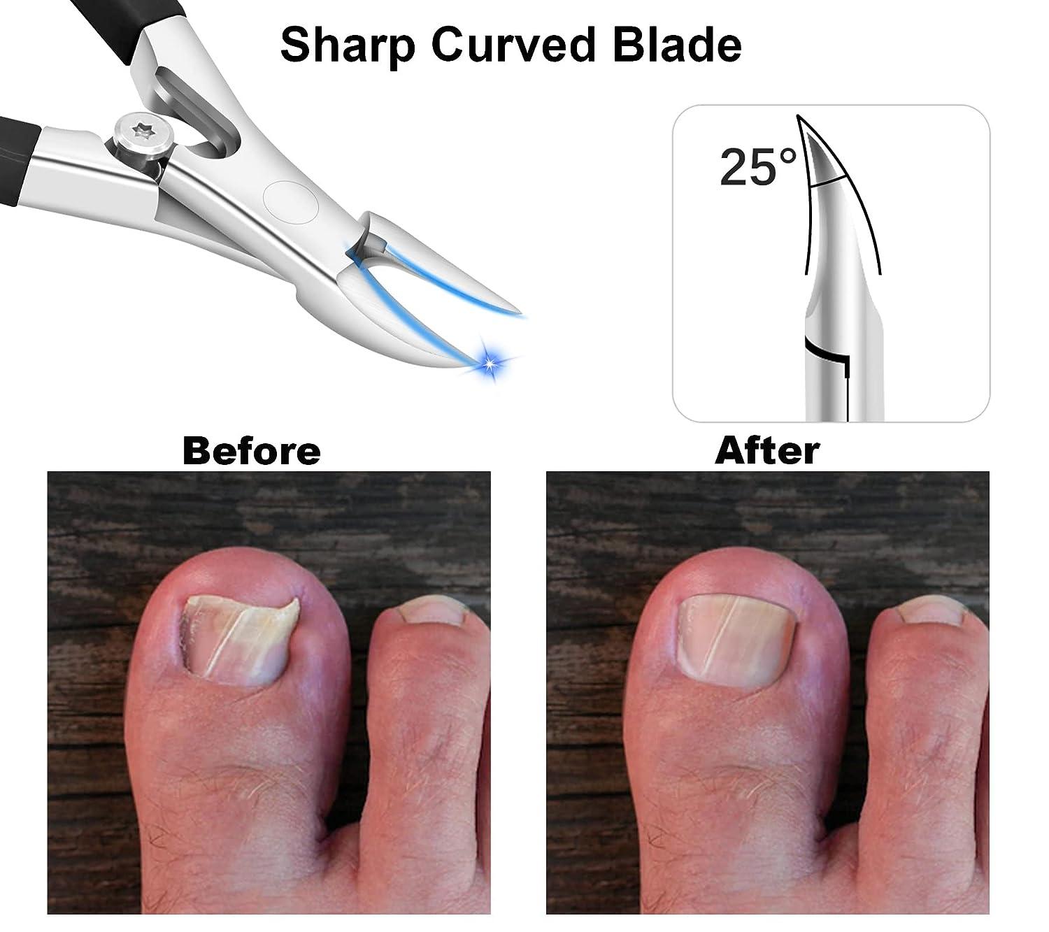 Professional Podiatrist Toenail Clippers for Thick and Ingrown Nails ...