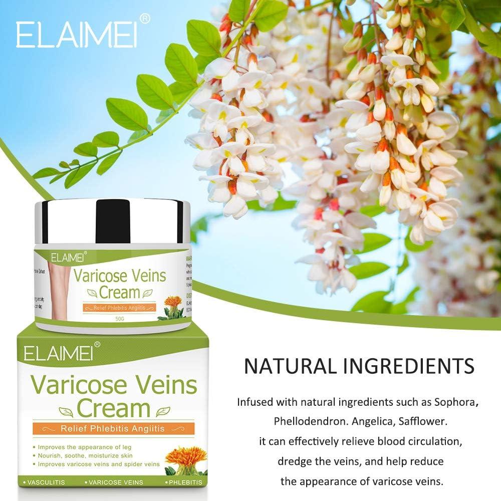 Varicose Veins Cream: Fast Relief for Phlebitis, Angiitis, Inflammation ...
