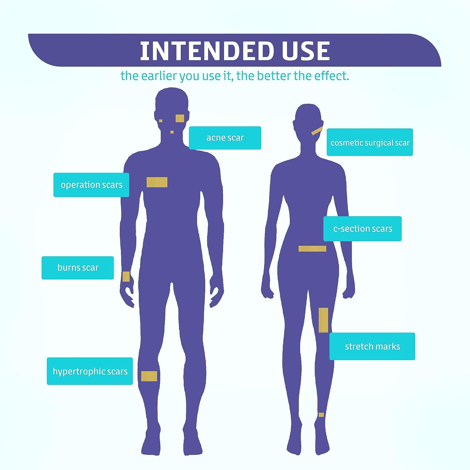 Silicone Scar Removal Sheets 2'' x 3'' - 5 Pack for Surgical, Burn ...