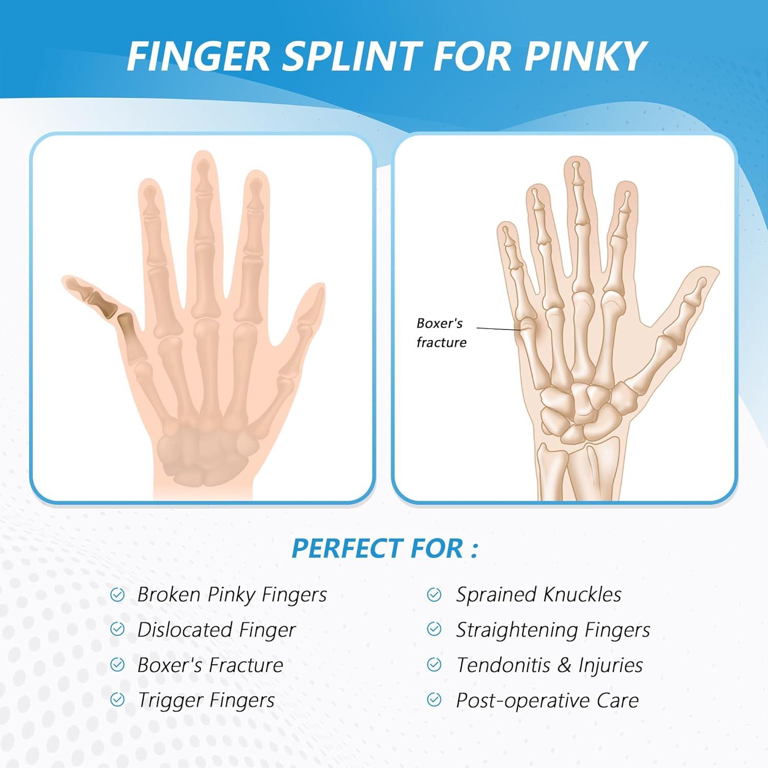 Pinky Finger Splint | Pain Relief Brace for Broken & Trigger Finger ...