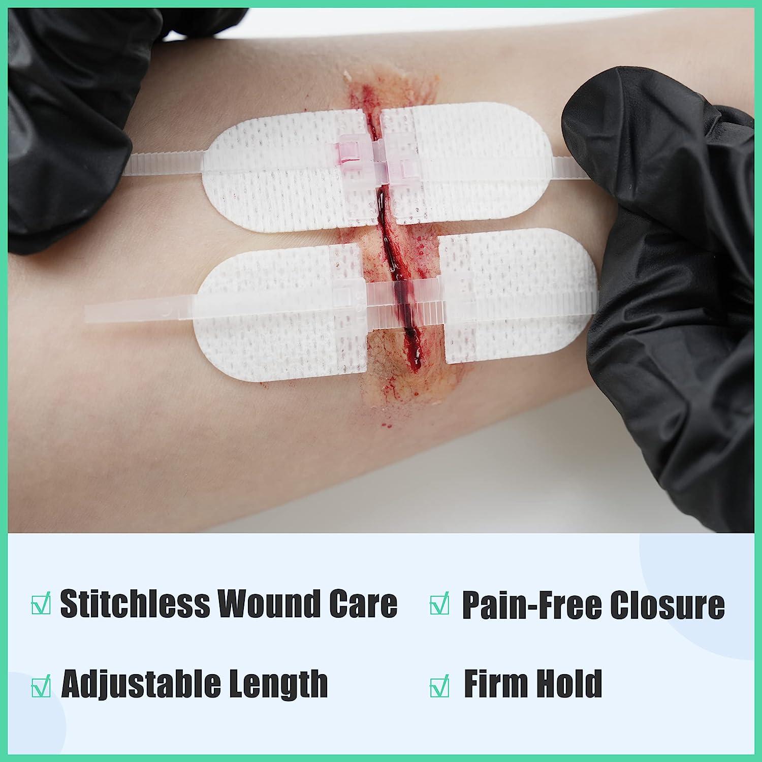 RHINO RESCUE Zip Stitch 6pcs | Wound Closure Strips Kit | Adhesive ...