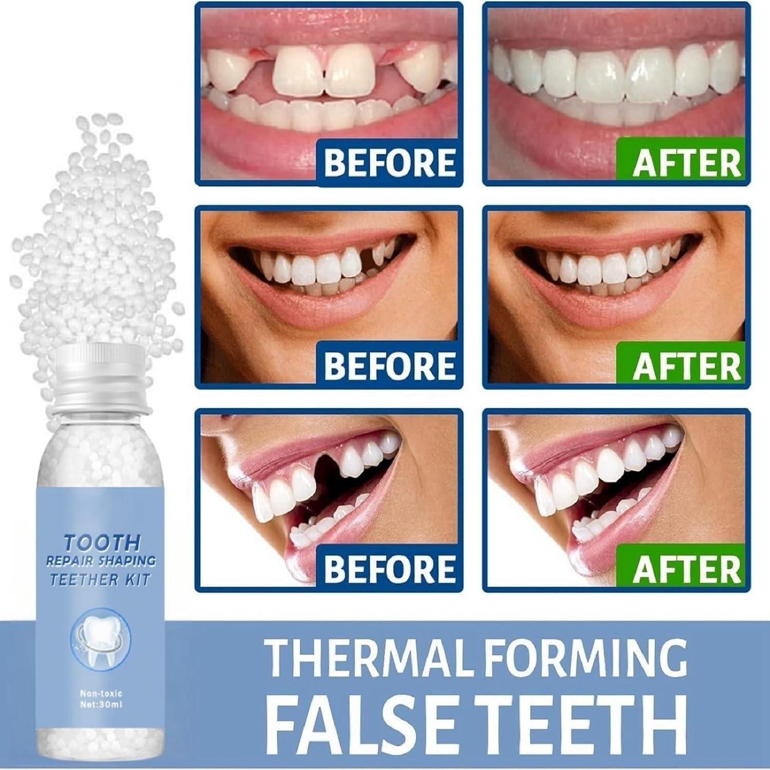 Temporary Tooth Repair Kit | Modable False Teeth & Filler Granules ...