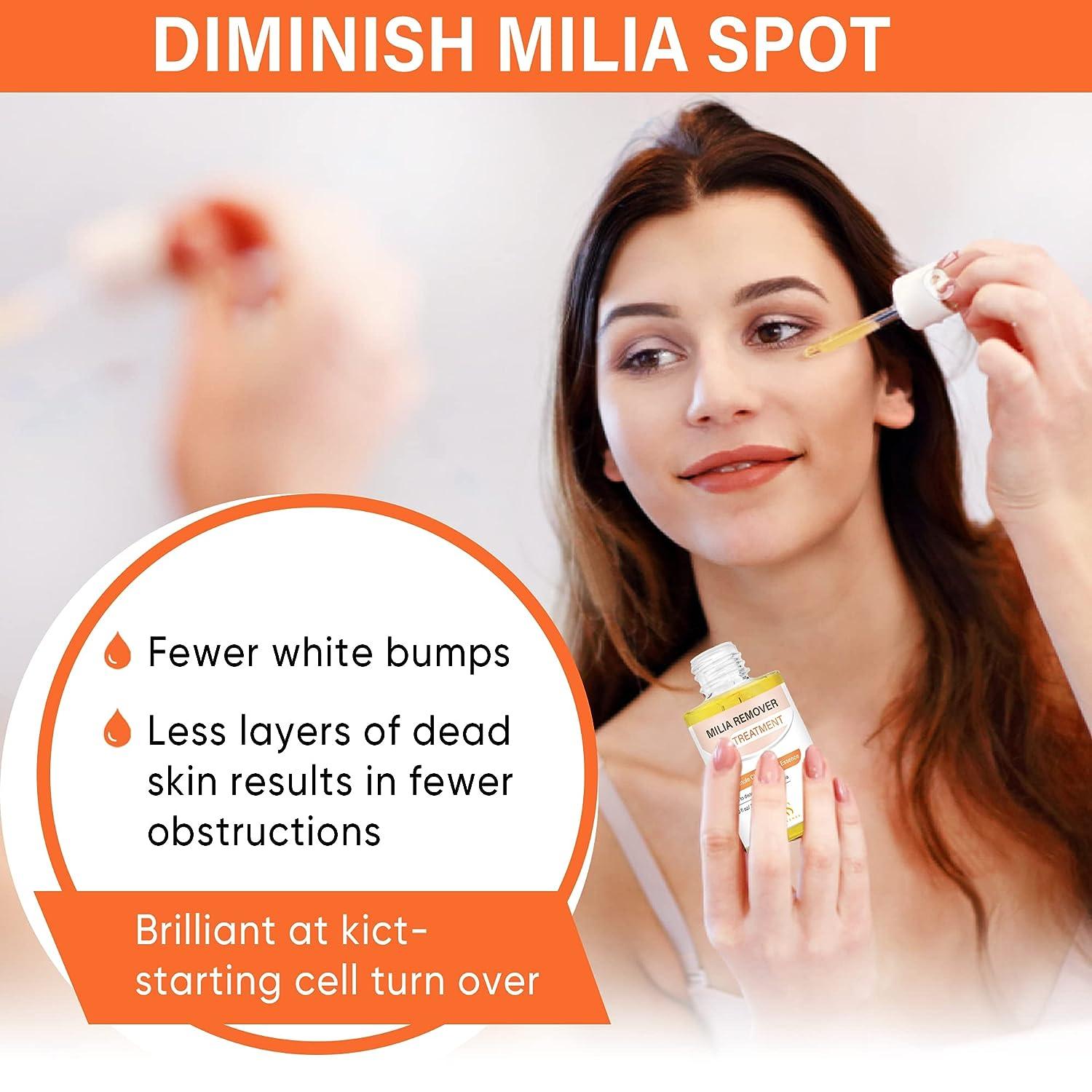 Milia Remover: Spot Treatment for Whitehead, Sebaceous Hyperplasia ...