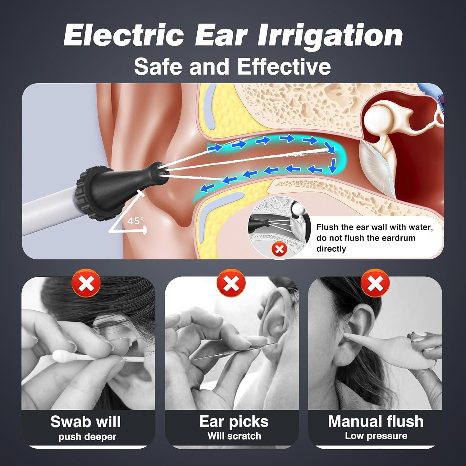 wax ear suction