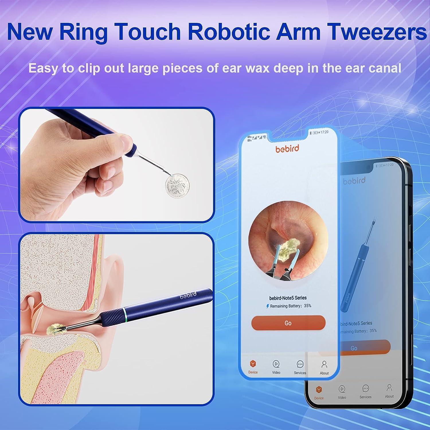 Bebird Note5 Pro Ear Wax Removal Tool Camera | 10MP HD Otoscope with Light | Ear Cleaner with ...