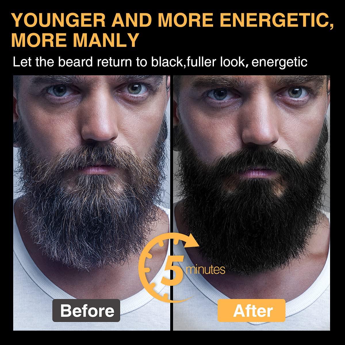 MGLIMZ Beard Coloring for Men - Instant Black Dye for Gray Hair - Easy ...