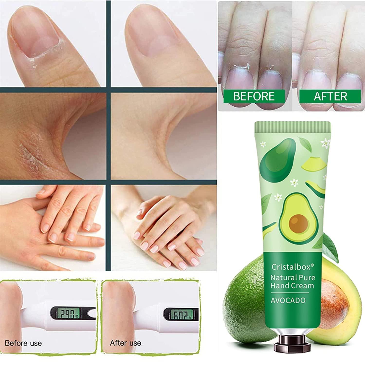 18 Pack Hand Cream Gift Set - Moisturizing Lotion for Dry, Cracked ...