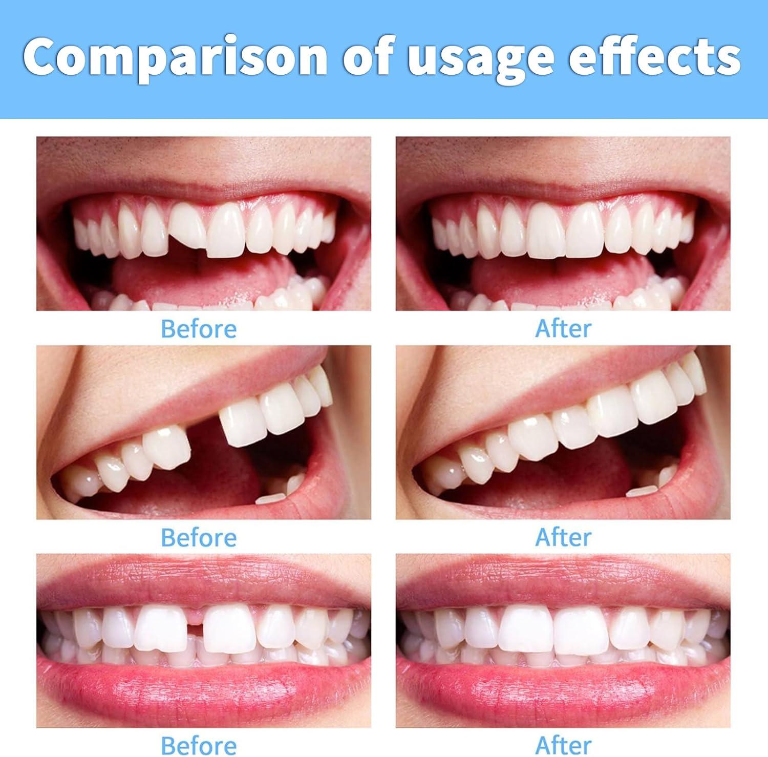 IjhyGD DIY Denture Kit Create Your Own Provisional Teeth Set Polymorph ...