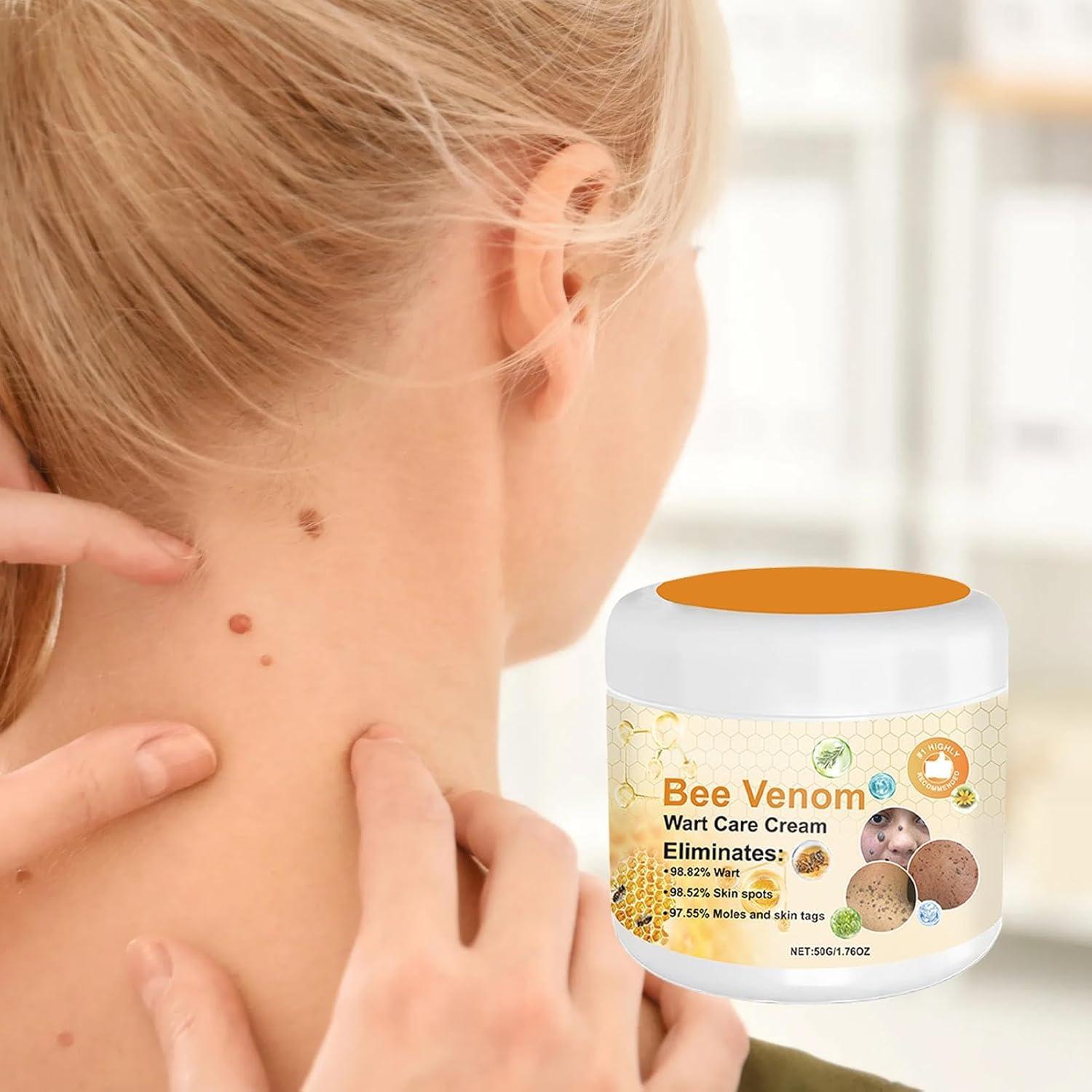 Bee Venoms Cream - Bee Venoms Wart and Tag Remover | Tag Recede Bee ...