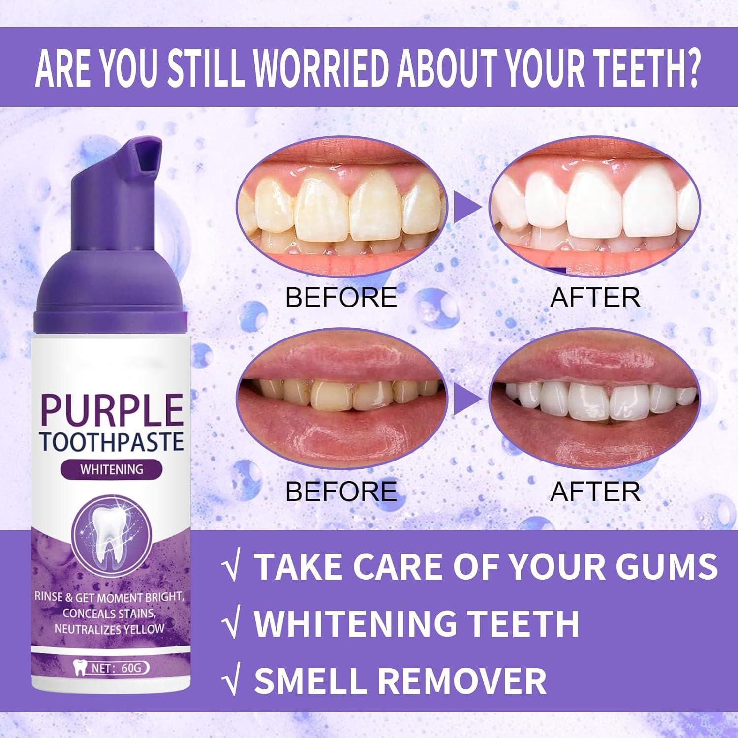 Purple Toothpaste for Whitening | Effective Stain Removal for Bright ...