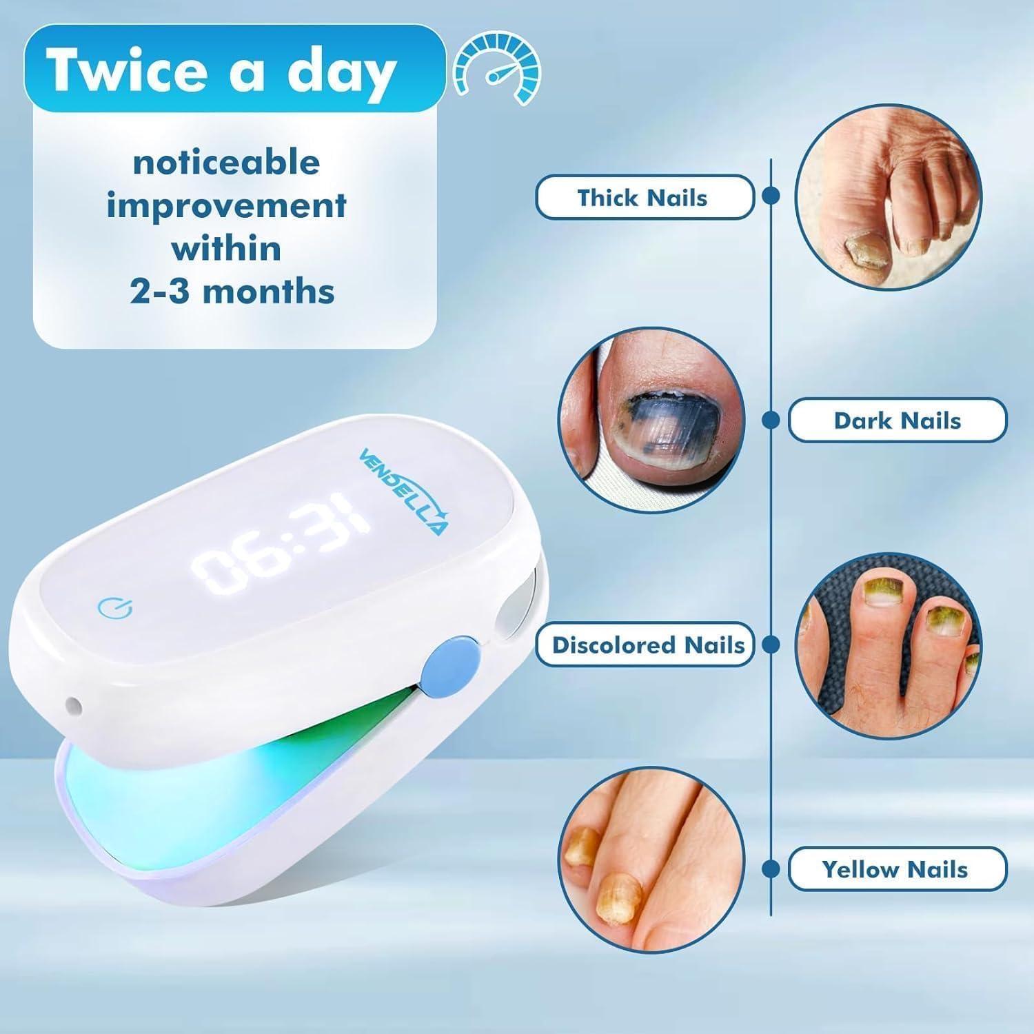 VENDELLA Touchscreen Nail Fungus Laser Treatment Device Rechargeable ...
