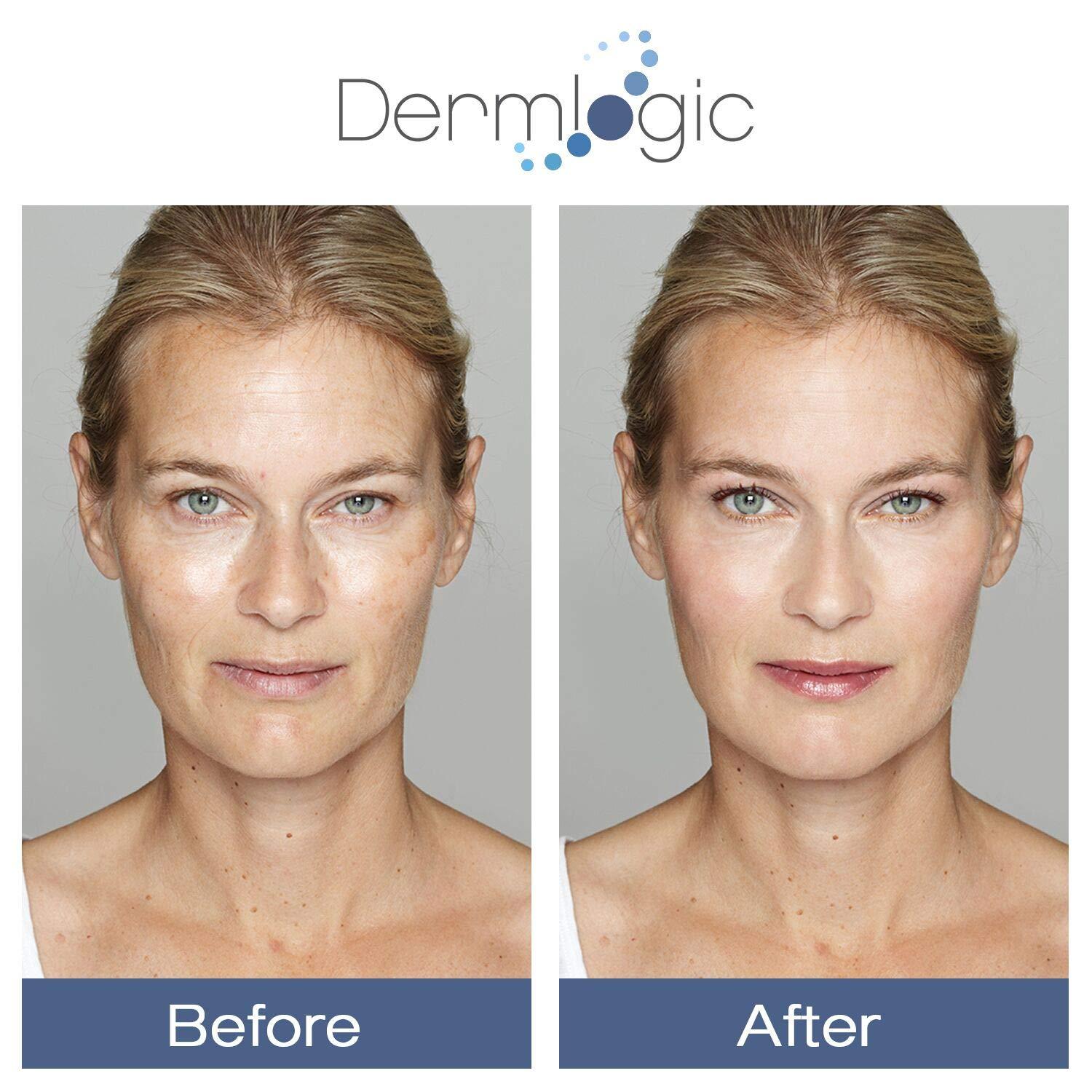 Dark Spot Corrector Serum | Fades Age Spots Acne Scars & Freckles ...